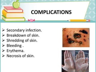 Atopic Dermatitis.pptx dermatitis skin inf | PPTX