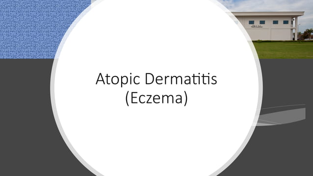 Atopic Dermatitis-Definition, symptoms and it main pathophysiology | PPT