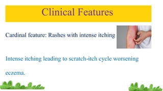 Atopic Dermatitis.pptx in pediatrics, presentation | PPTX