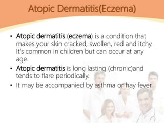 Atopic dermatitis Immunology | PPTX