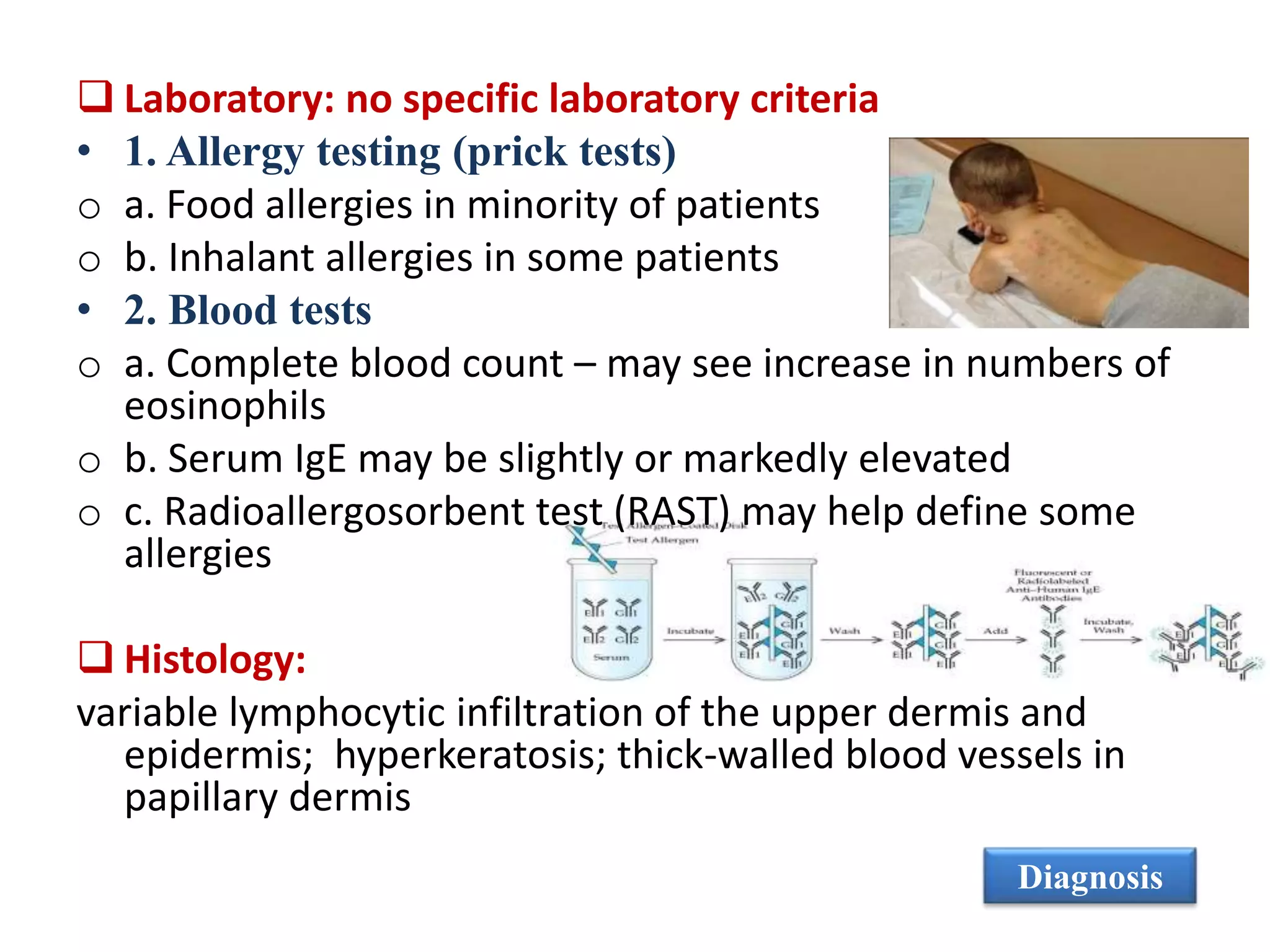 Atopic dermatitis in children | PPTX