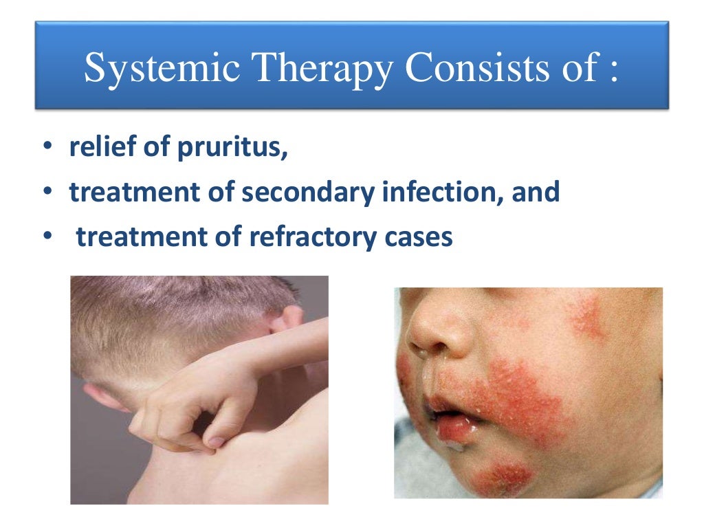 Atopic dermatitis in children