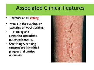 atopicdermatitis new ppt download free and enjoy | PPTX