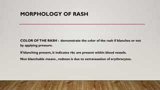 Atopic dermatitis,eczema, Etiology, pathology, diagnosis, management ...