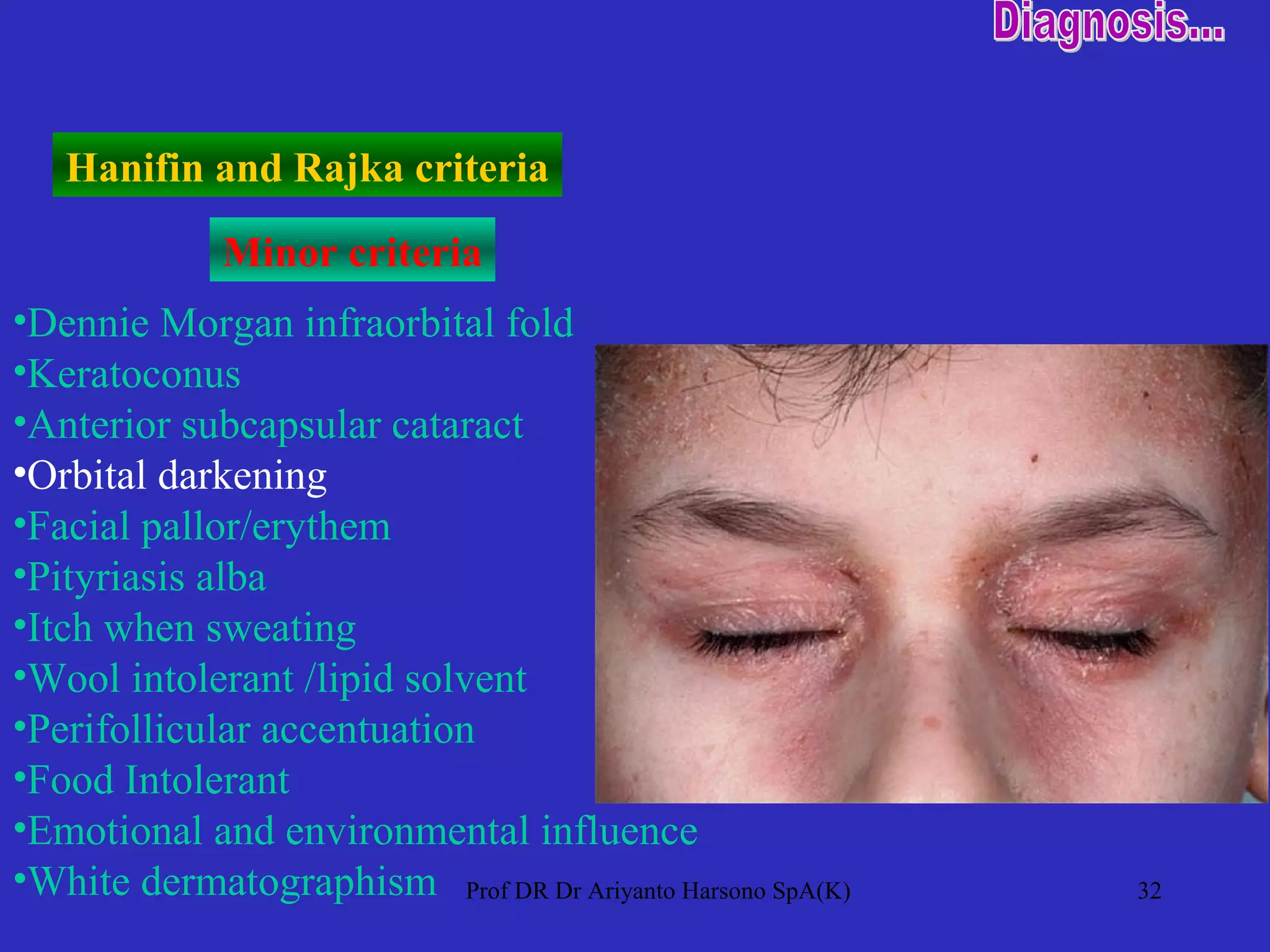 Atopic dermatitis treatment, from conventional to unconventional | PPT
