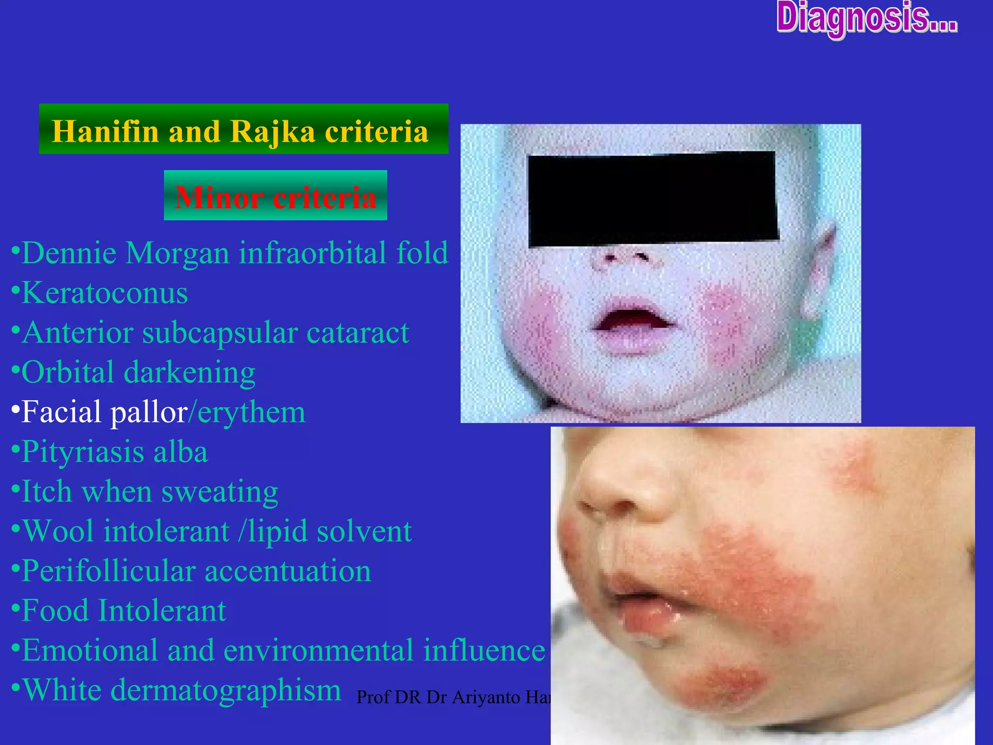 Atopic dermatitis treatment, from conventional to unconventional | PPT