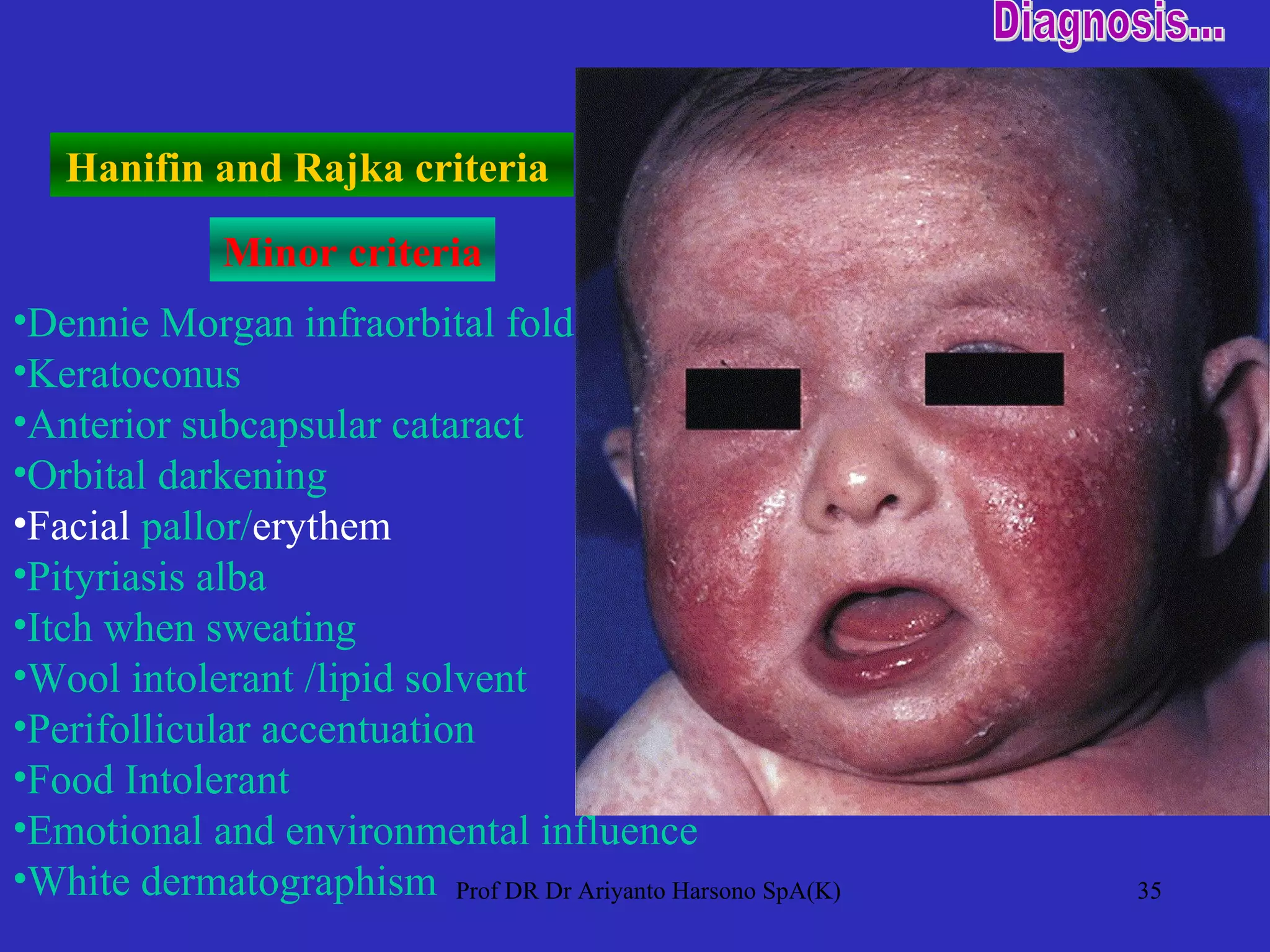 Atopic dermatitis treatment, from conventional to unconventional | PPT