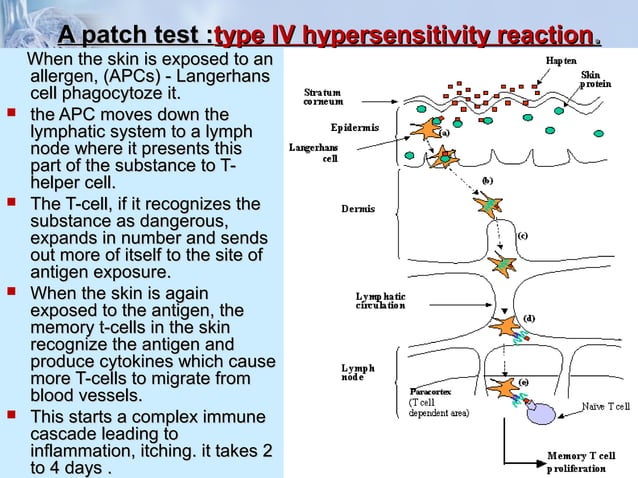 Atopy Patch Test Ppt