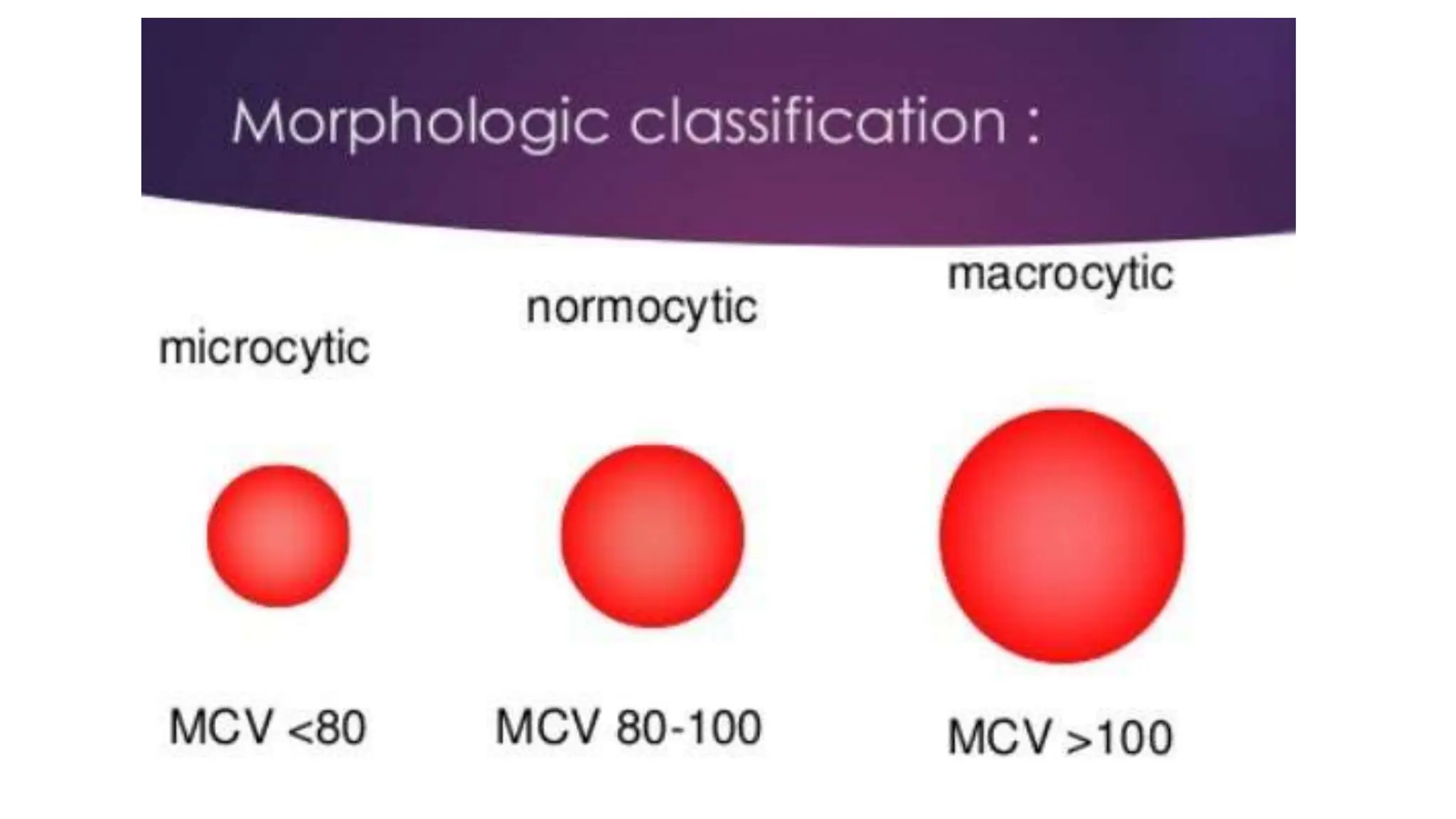 Anemia: classification, IDA, Megaloblastic anemia - General Medicine ...