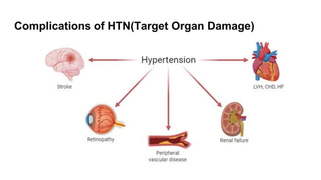 Hypertension: Causes, Pathogenesis - Pathology - ATOT | PPTX | Heart ...