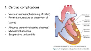Valvular Heart Diseases, Rheumatic Heart Disease, Infective ...