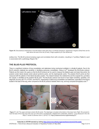 Point-of-Care Ultrasound Evaluation of Respiratory Function.pdf