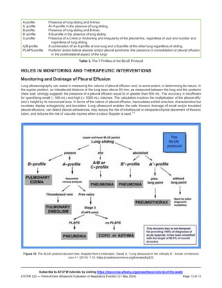 Point-of-Care Ultrasound Evaluation of Respiratory Function.pdf