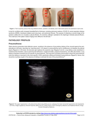 Point-of-Care Ultrasound Evaluation of Respiratory Function.pdf