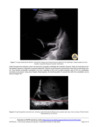 Point-of-Care Ultrasound Evaluation of Respiratory Function.pdf