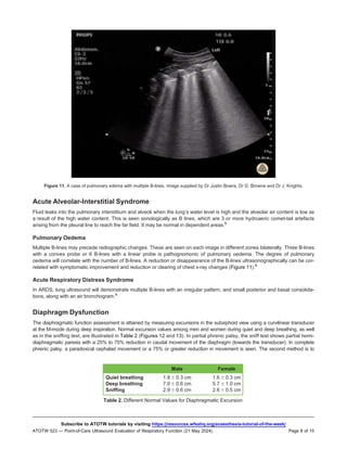 Point-of-Care Ultrasound Evaluation of Respiratory Function.pdf