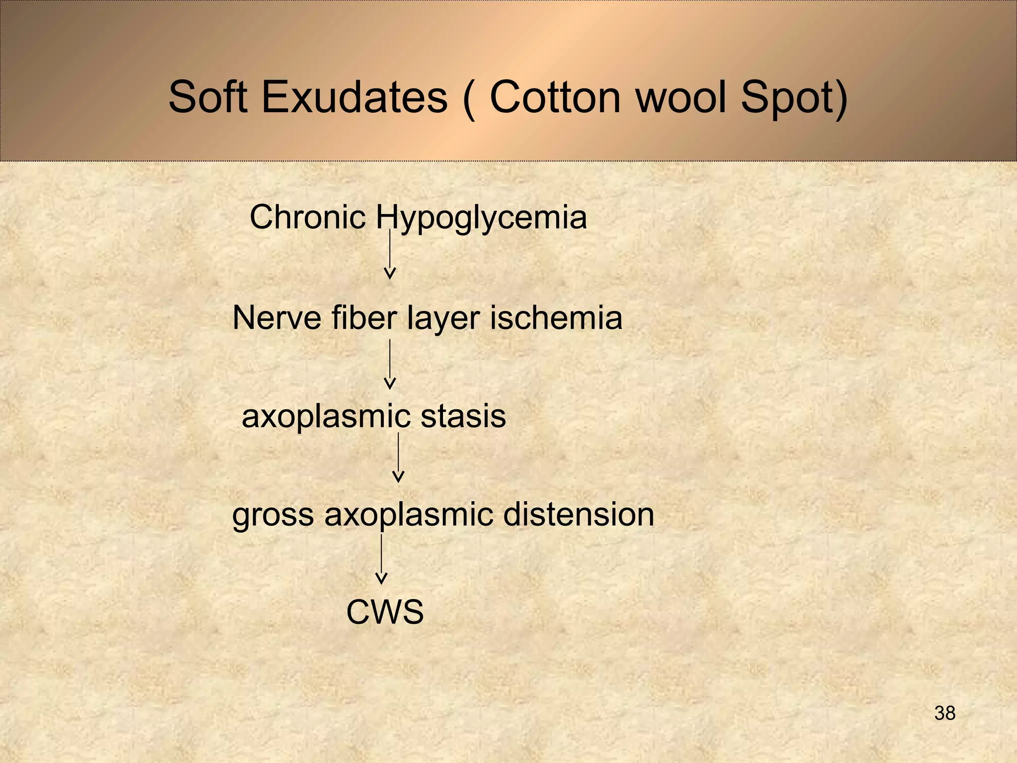 A to z of diabetic retinopathy | PPT