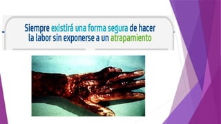 ATRAPAMIENTO DE MIEMBROS - AUTOCUIDOADO - SEGURIDAD.pptx