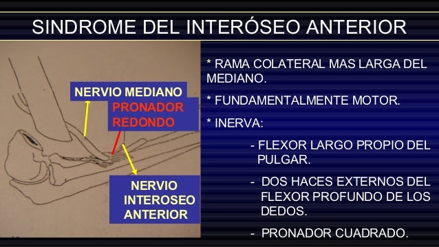 Atrapamiento nervio mediano en miembro superior