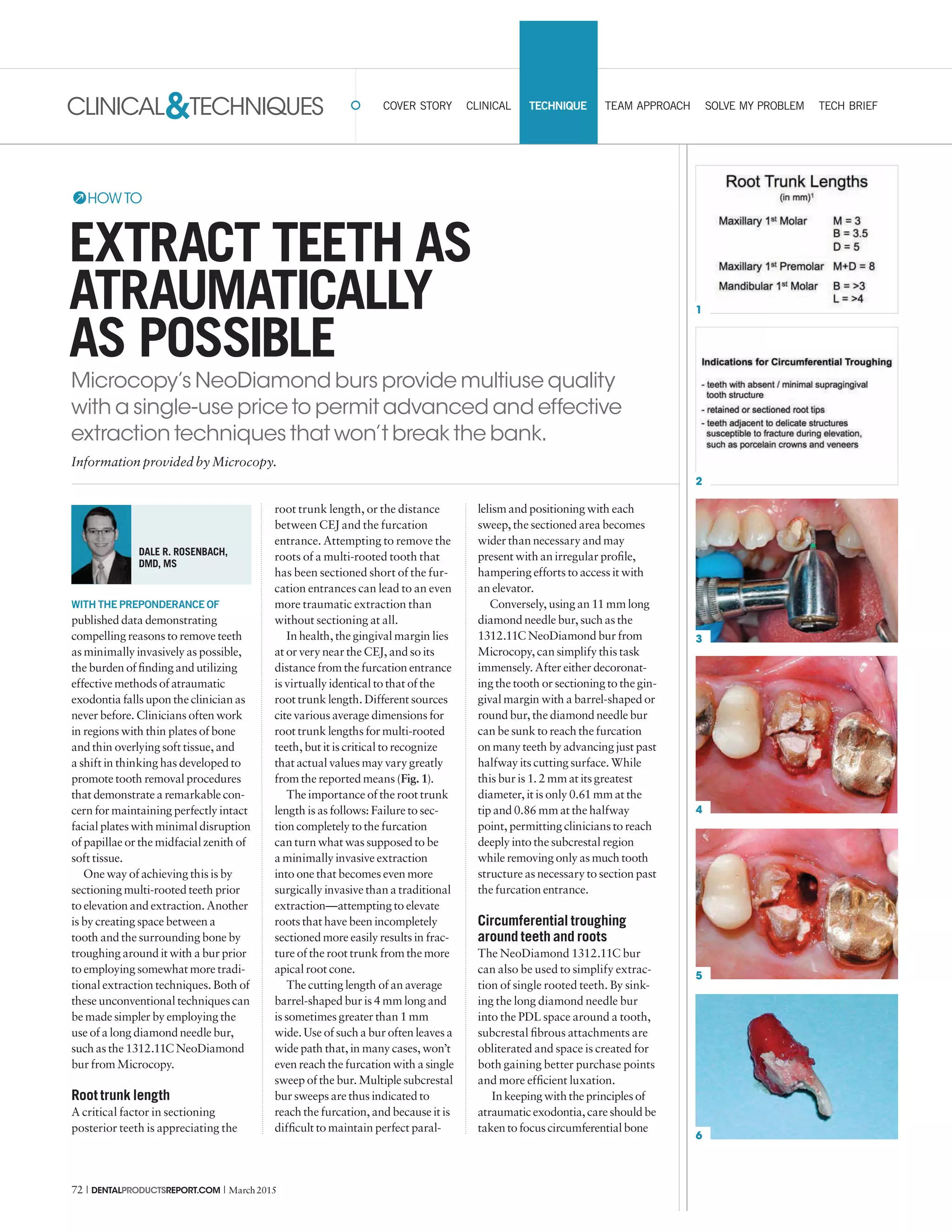 How to Extract a Tooth as Atraumatically as Possible (Rosenbach 2015) | PDF
