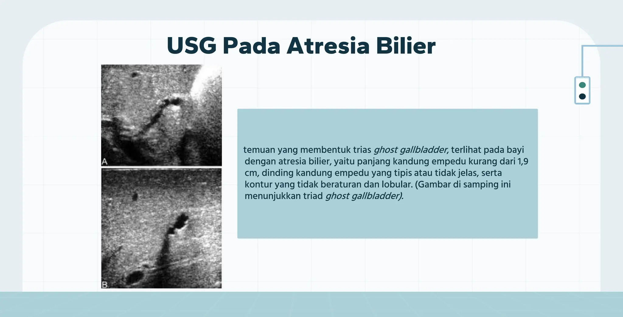 ATRESIA BILIER PADA PEMERIKSAAN RADIOLOGI.pptx