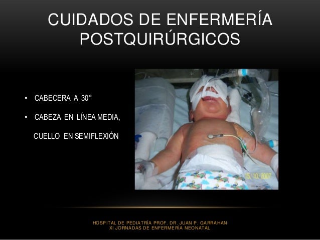 Atresia de esófago Cuidados de Enfermería