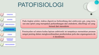 Atresia duodenum | PPTX