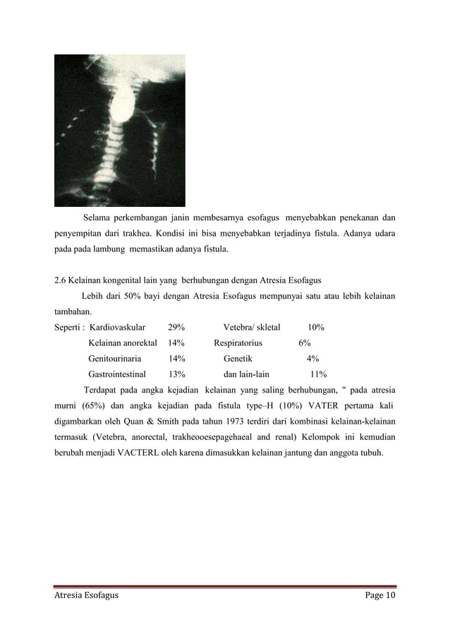 Atresia esofagus | DOCX