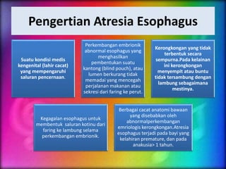Atresia Esofagus | PPTX
