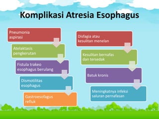 Atresia Esofagus | PPTX