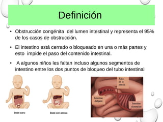 Atresia intestinal | ODP