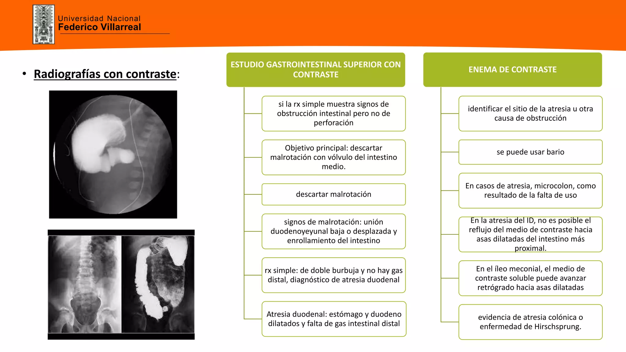 ATRESIA_INTESTINAL.pptx