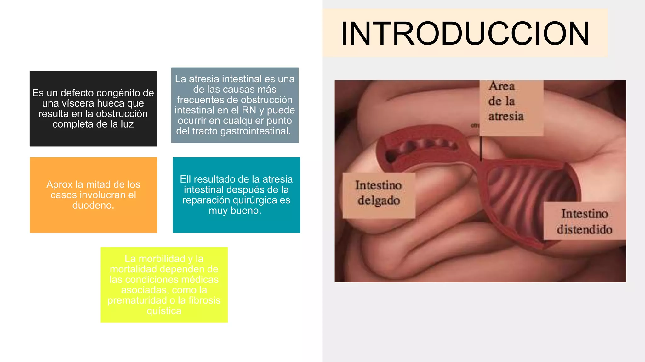 ATRESIA_INTESTINAL.pptx