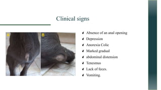 Atresi ani and Recto-vaginal fistula.pptx