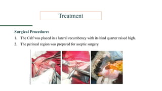 Atresi ani and Recto-vaginal fistula.pptx