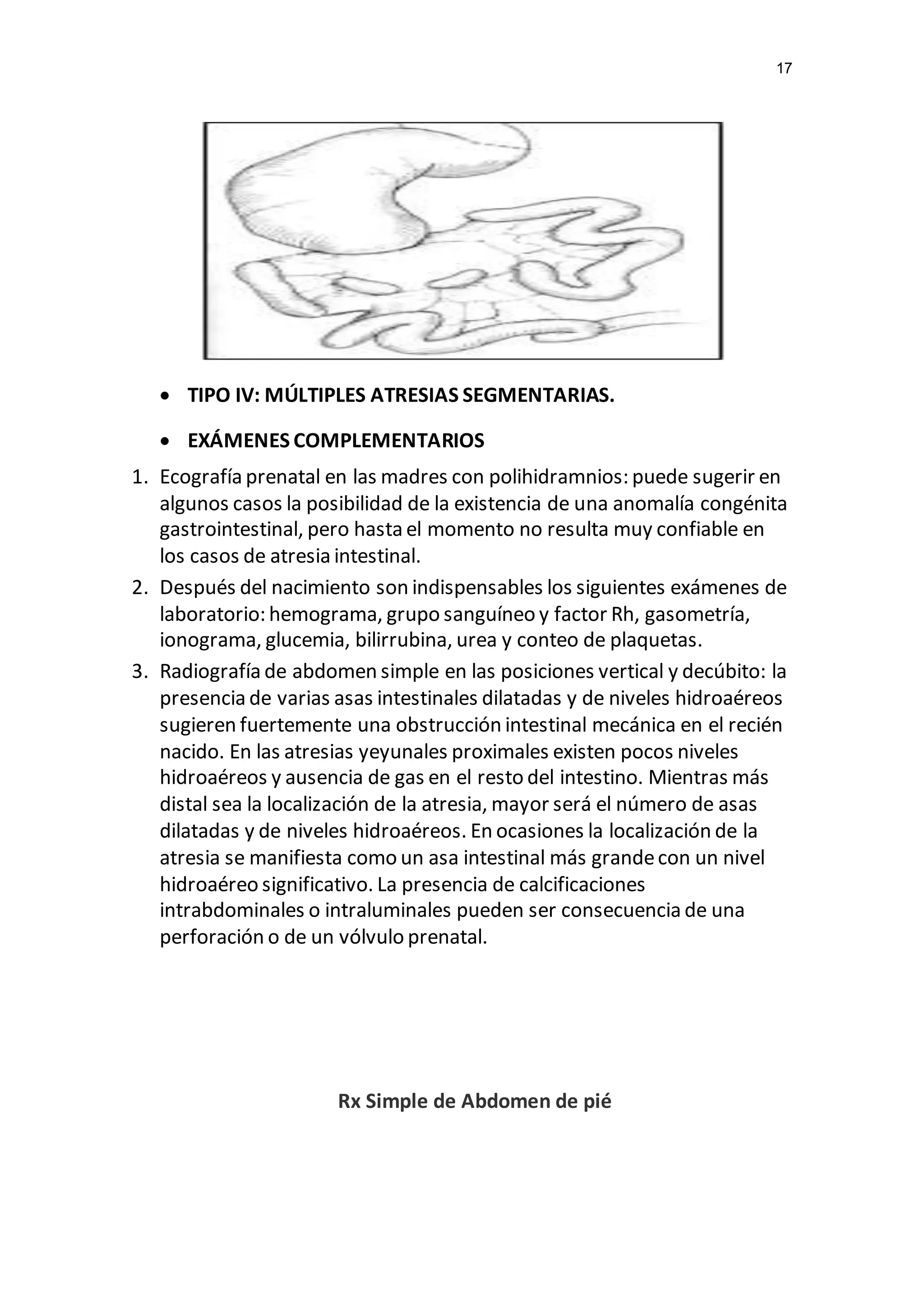 Atresias intestinales y anorectales | DOCX