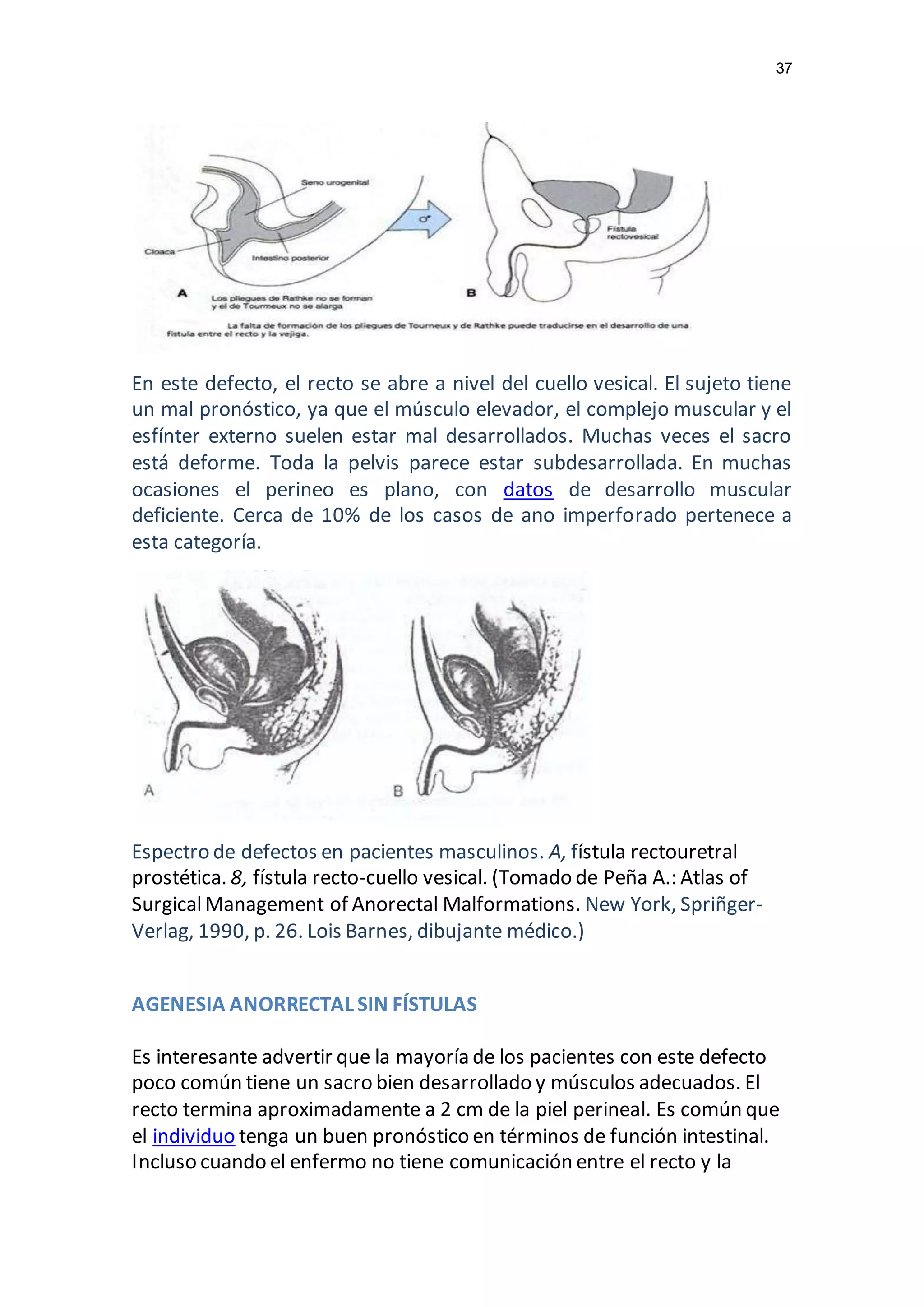 Atresias intestinales y anorectales | DOCX