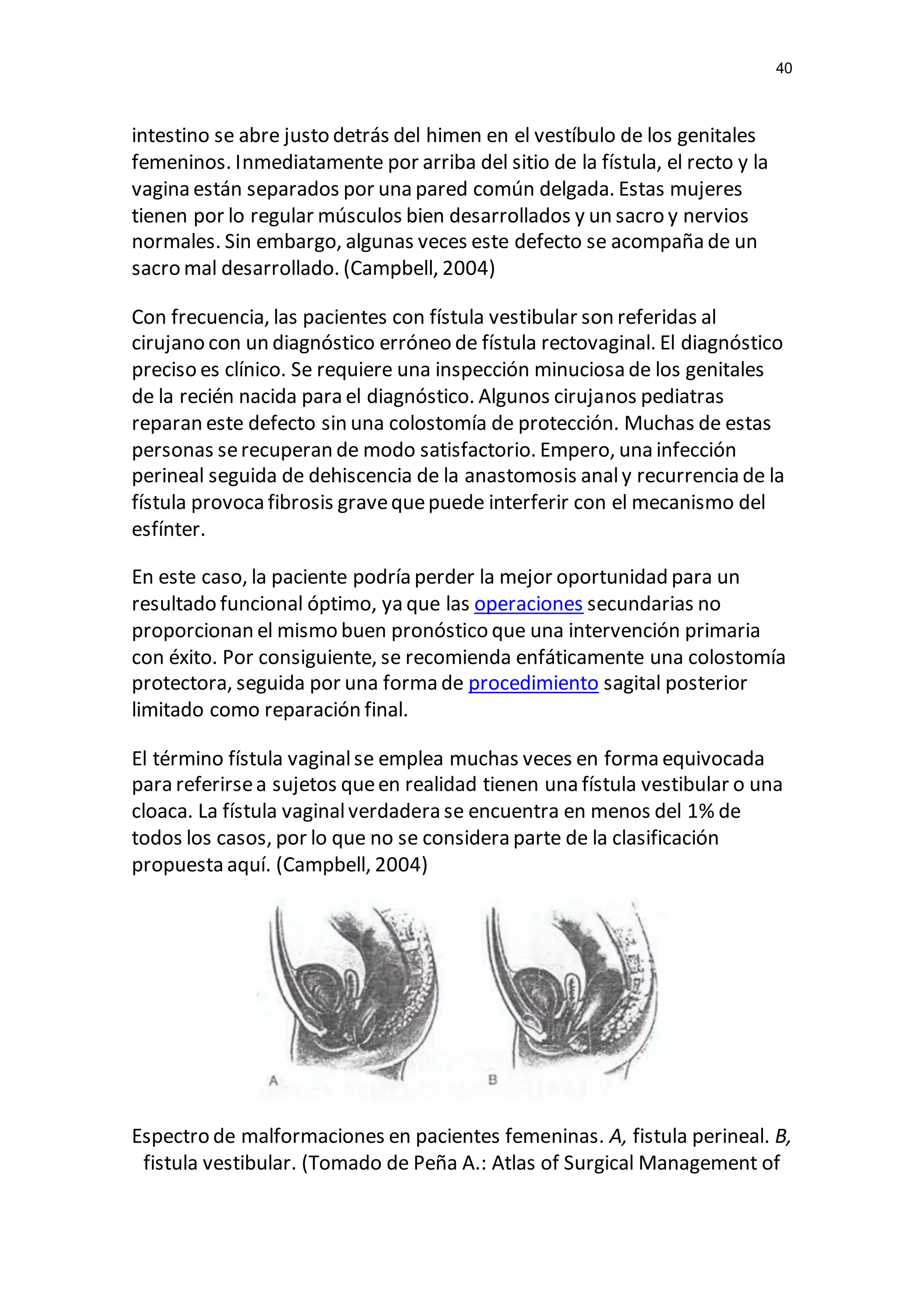 Atresias intestinales y anorectales | DOCX