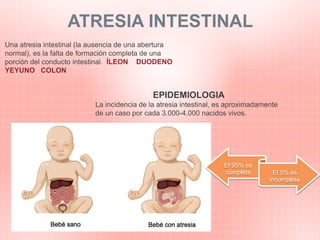 ATRESIA Y ESTENOSIS DEL DUODENO.pptx CIRUGIA PEDIATRICA | PPTX