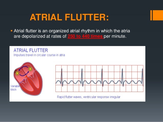 ATRIAL ARRHYTHMIAS