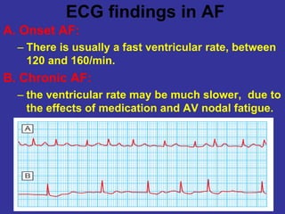 Atrial ﬁbrillation review of principles | PPTX | Heart and ...