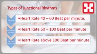 Atrial dysrhythmia | PPT
