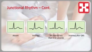 Atrial dysrhythmia | PPT