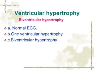 Atrial enlargement and ventricular.ppt