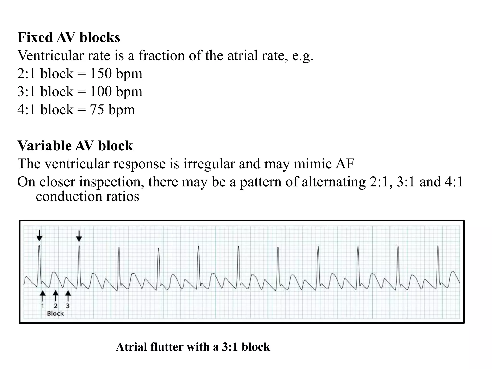 Atrial fib & flutter | PPTX