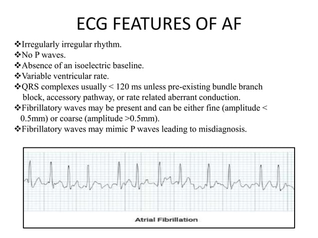 Atrial fib & flutter | PPTX | Heart and Cardiovascular Diseases ...