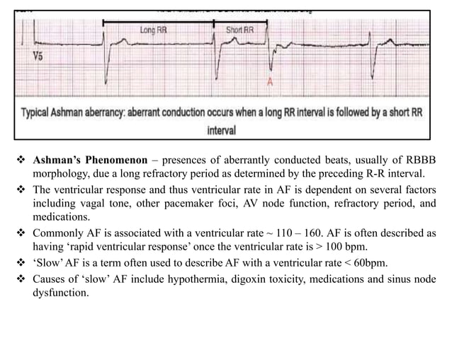 Atrial fib & flutter | PPTX | Heart and Cardiovascular Diseases ...