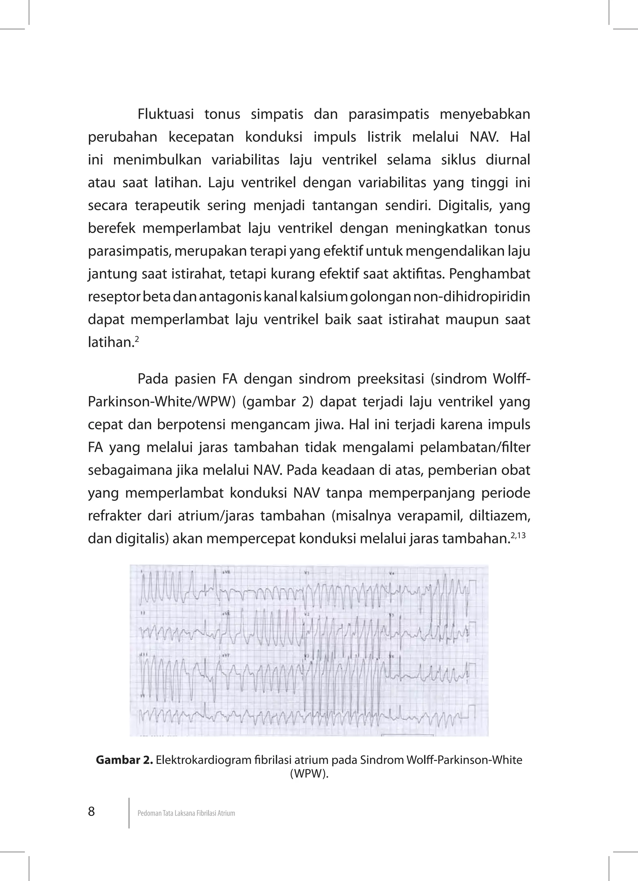 Atrial Fibrilasi.pdf