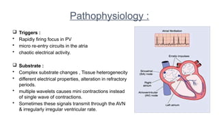 New onset of atrial fibrillation pptx.pptx