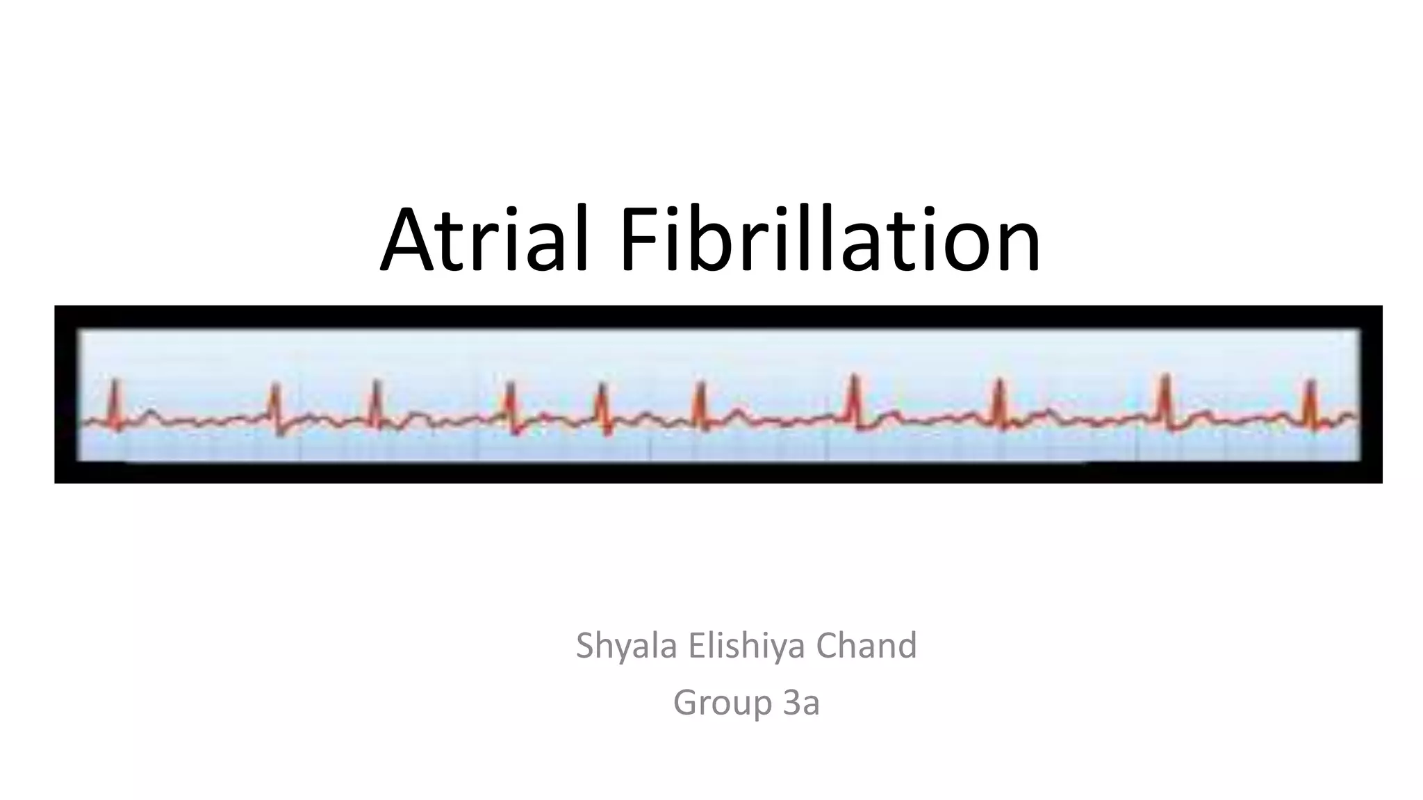 Atrial fibrillation | PPTX